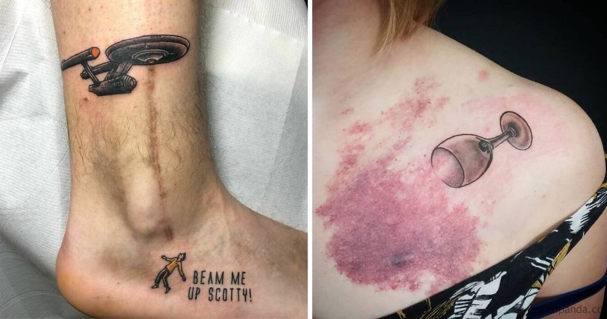 20+ Tattoos Turn Your Scars Into Impressive Signatures