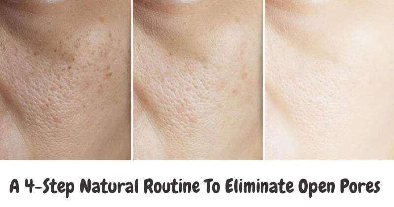 Say Goodbye To Open Pores On Your Face With This Natural 4-Step Remedy