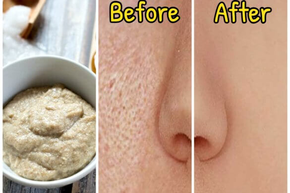 Benefits And Recipes Of Flaxseed Gel And Okra Gel