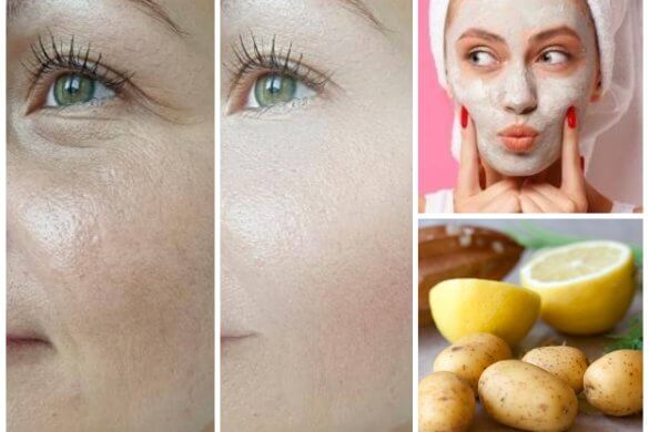 Lemon For Face And Skin: Benefits And How To Use It