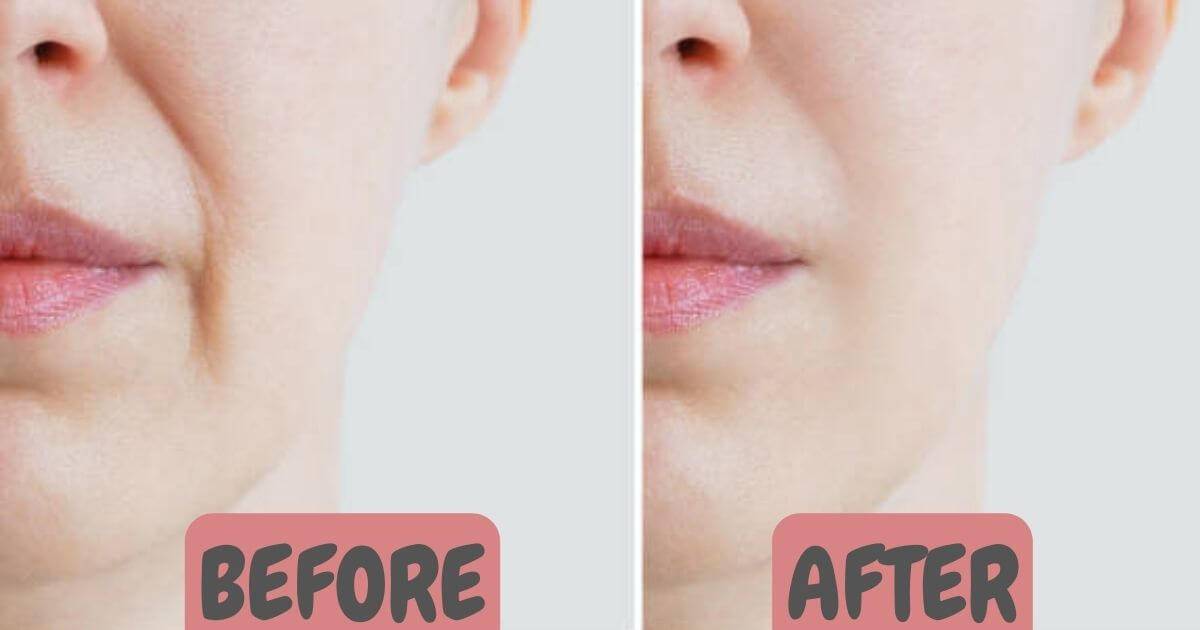 Practicing These 4 Facial Exercises To Tighten Your Skin