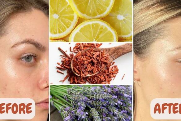 5 Easy Strawberry Face Packs To Make Your Skin Glow