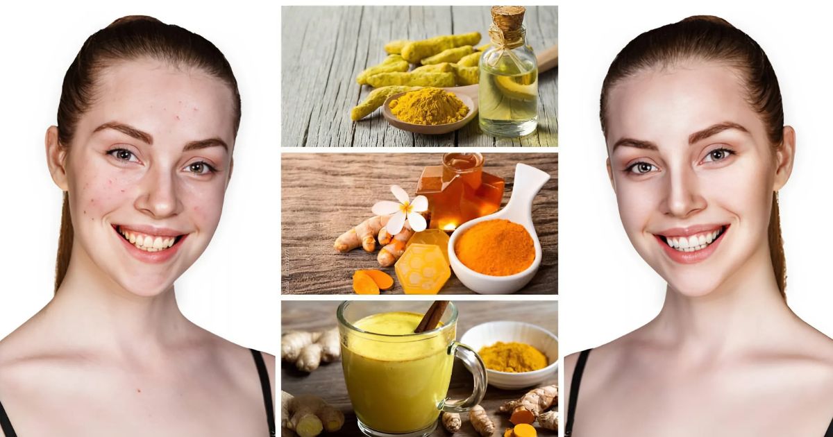 7 Benefits Of Turmeric For Your Skin And How To Use It