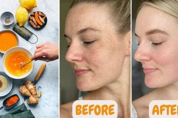 Only 3 Steps For Tomato Home Remedy That Are Best Fit Your Glowing Skin