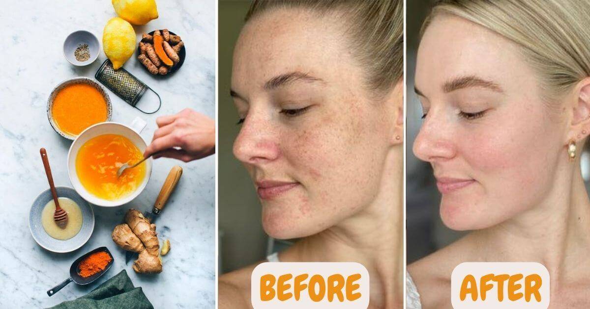 Get Back Your Dazzling Eyes With Tumeric Paste