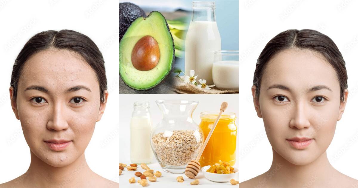 Top 5 Milk Face Packs You Need To Include In Your Everyday Skincare Routine