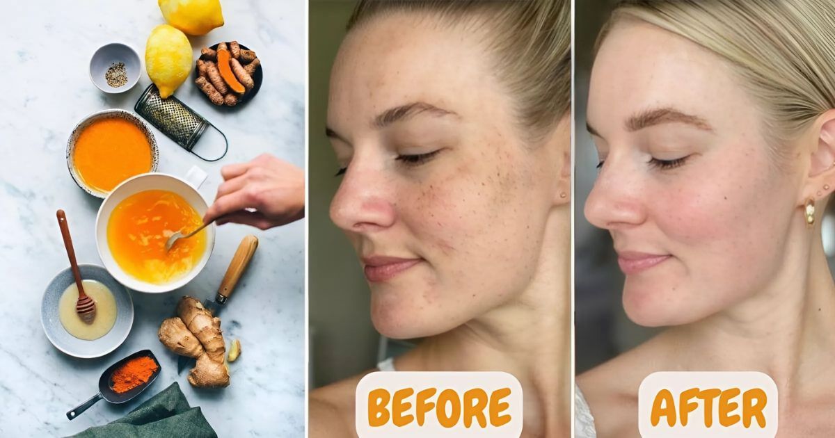 Get Back Your Dazzling Eyes With Tumeric Paste