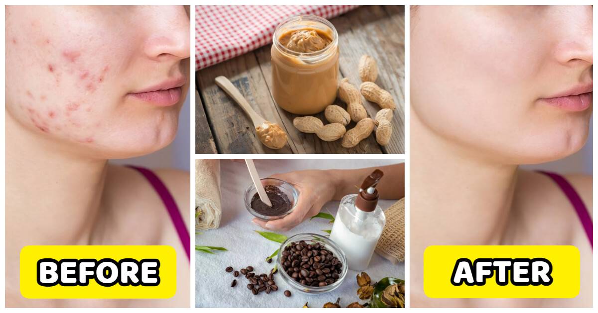 6 Simple Food Ingredients That Can Be Used As Face Masks