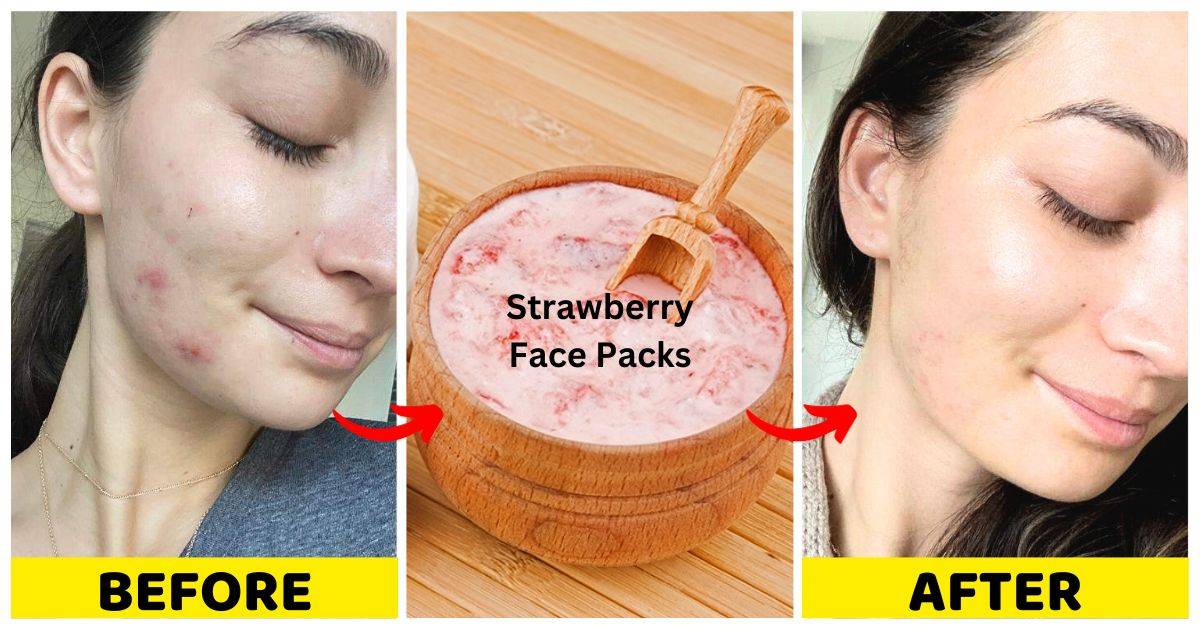 5 Easy Strawberry Face Packs To Make Your Skin Glow