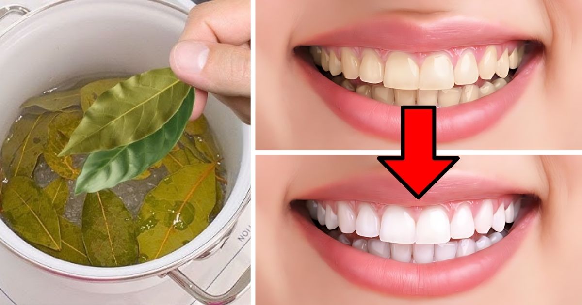 9 Popular Insect Bites and How to Identify, Treat, and Prevent Them ...