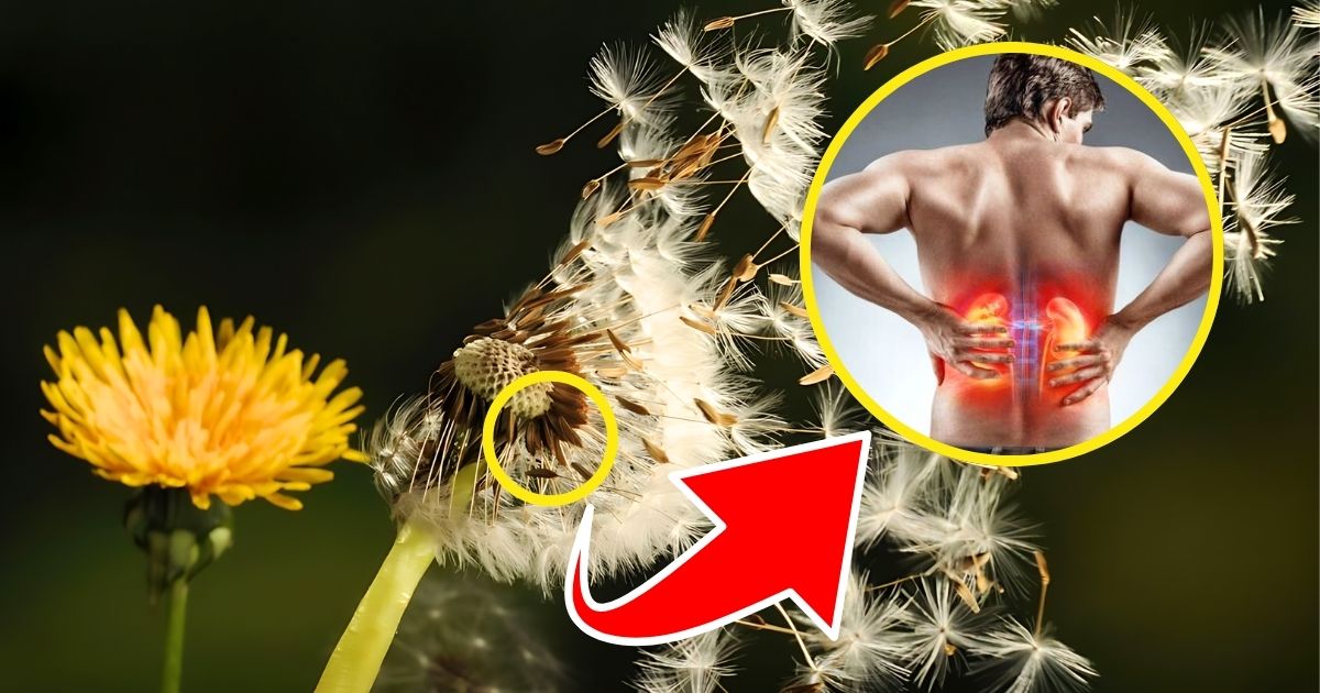 9 Popular Insect Bites and How to Identify, Treat, and Prevent Them ...