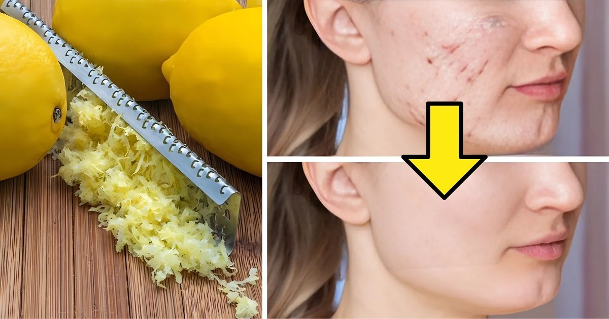 Unlock the Power of Lemon Peel: Surprising Health Benefits and How to ...
