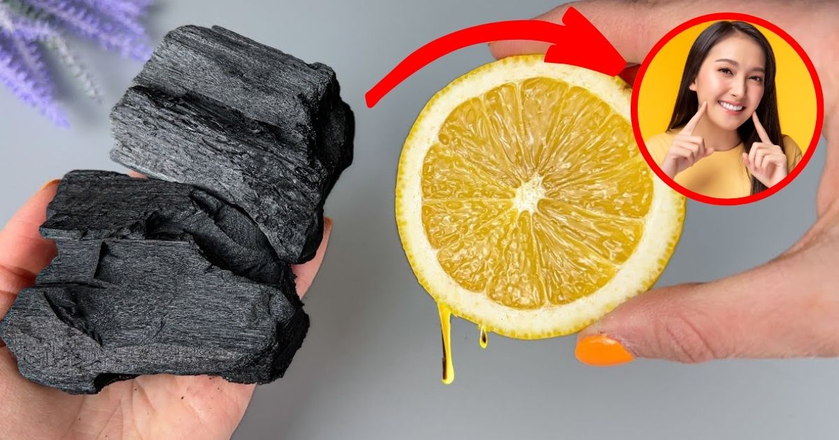 Want a Brighter Smile and Healthier Skin? Discover the Magic of Lemon ...