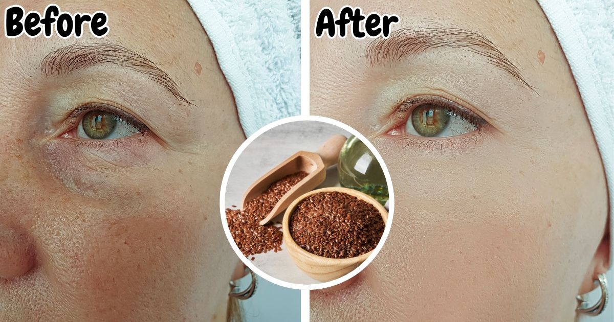 Flaxseed Benefits for Wrinkles: Science-Backed Skincare That Works