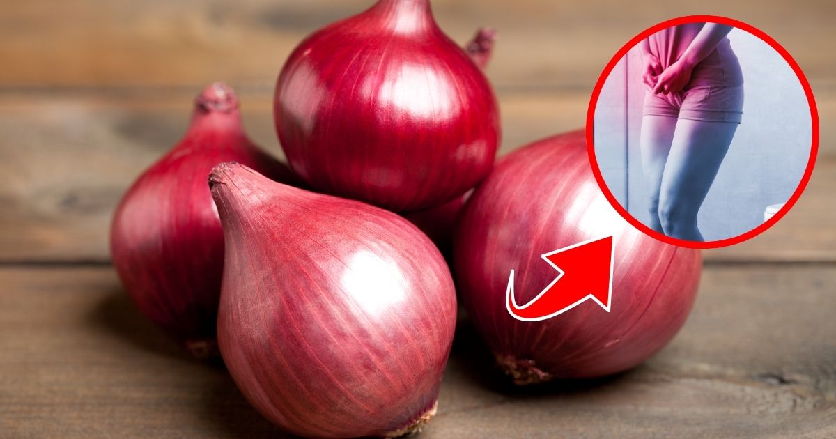 The Incredible Health Benefits of Onions (Allium cepa) for Your Bladder ...