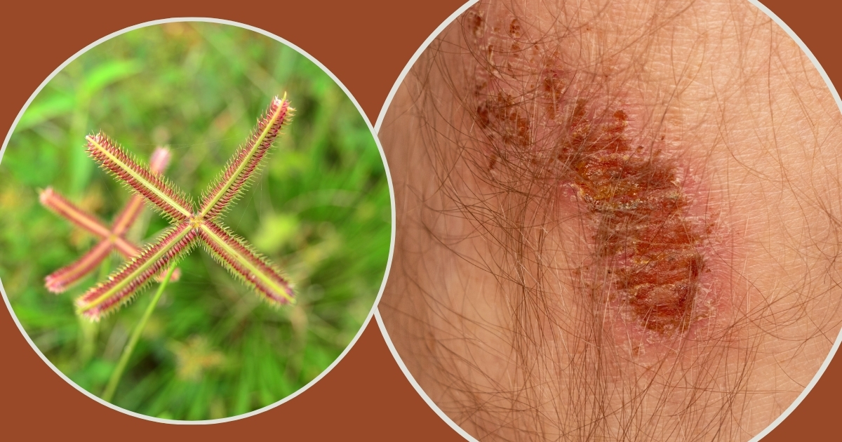 7 Incredible Ways Crowfootgrass Can Improve Your Health