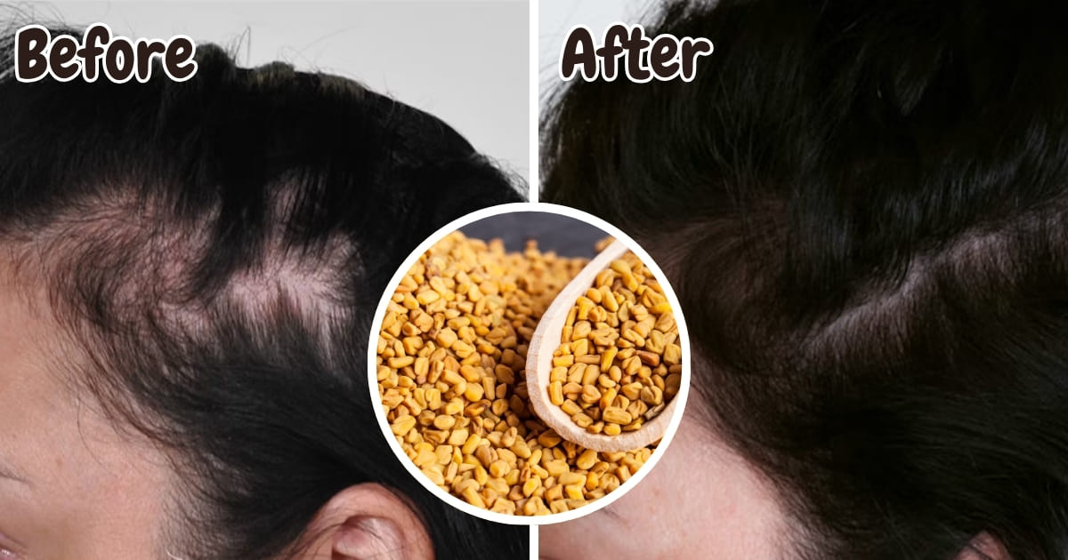 Fenugreek Seeds for Hair: Unlock the Secret to Stronger, Shinier, and ...