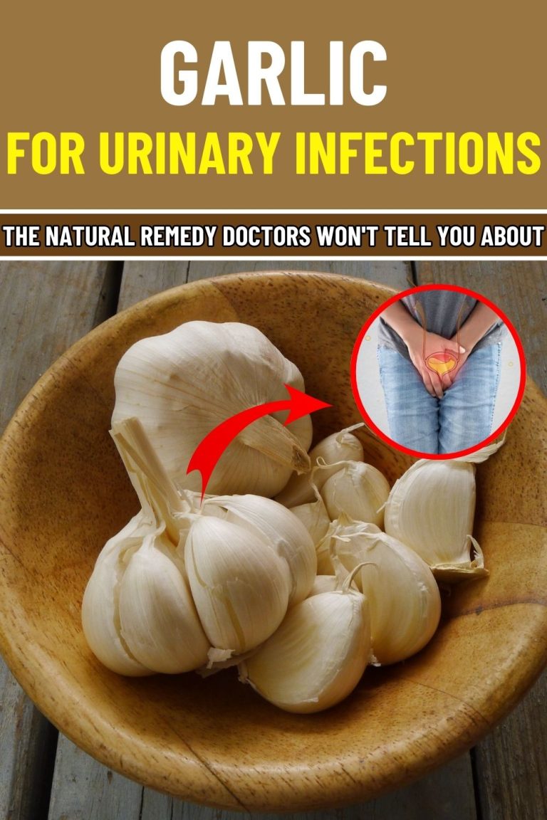 Garlic for Urinary Infections? The Natural Remedy Doctors Won’t Tell ...
