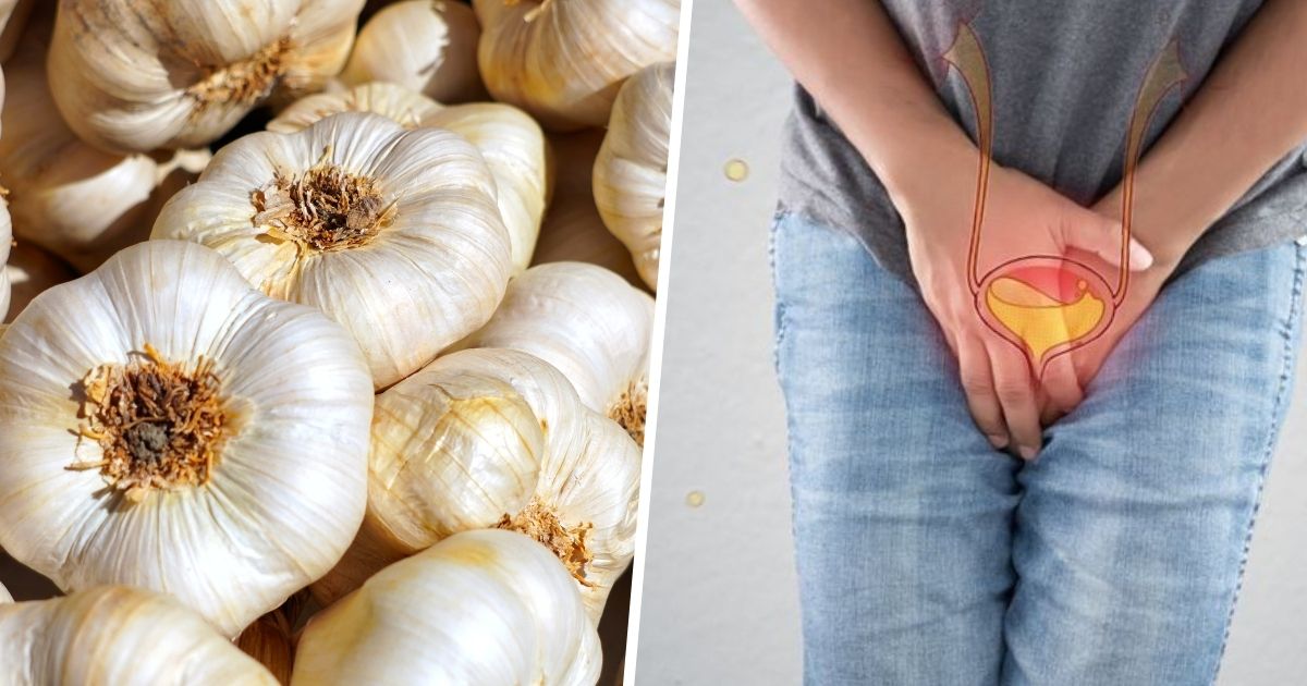 Garlic for Urinary Infections? The Natural Remedy Doctors Won’t Tell ...