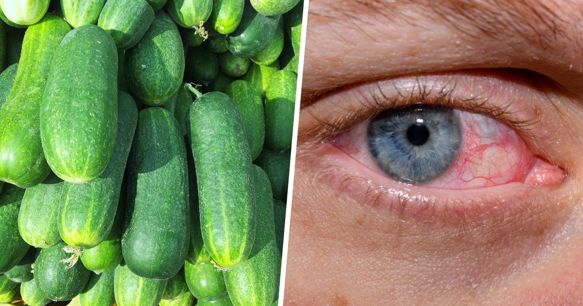 Cucumber for Eyes: A Simple Yet Powerful Fix for Eye Strain and Dark ...