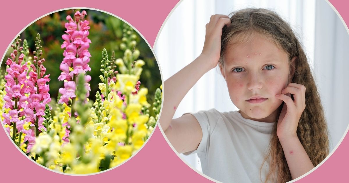 Snapdragon: The Stunning Flower with Hidden Health Superpowers