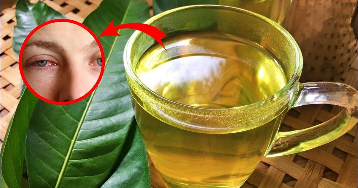 How Mango Leaf Tea Fights Cataracts, Blurry Vision, and Eye Fatigue