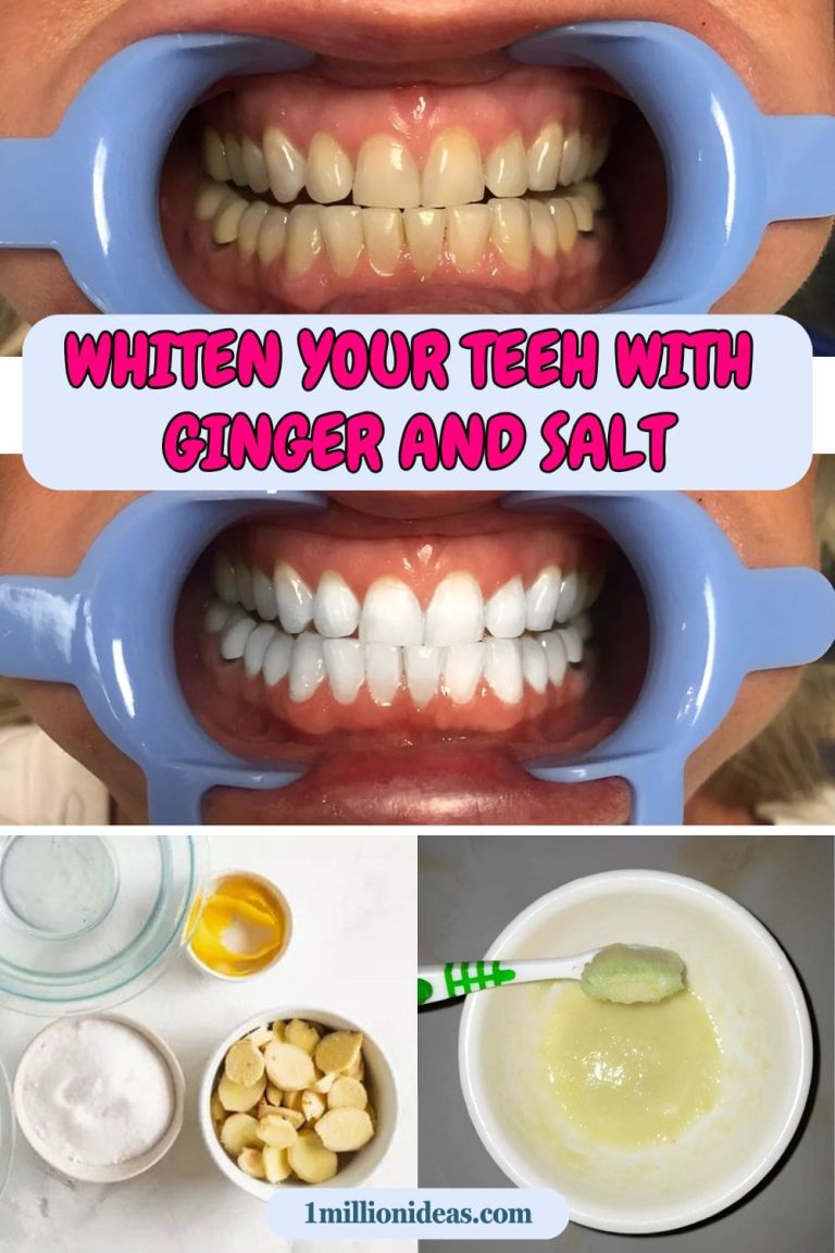 Whiten Your Teeth Instantly with This 2-Minute Ginger and Salt Trick ...
