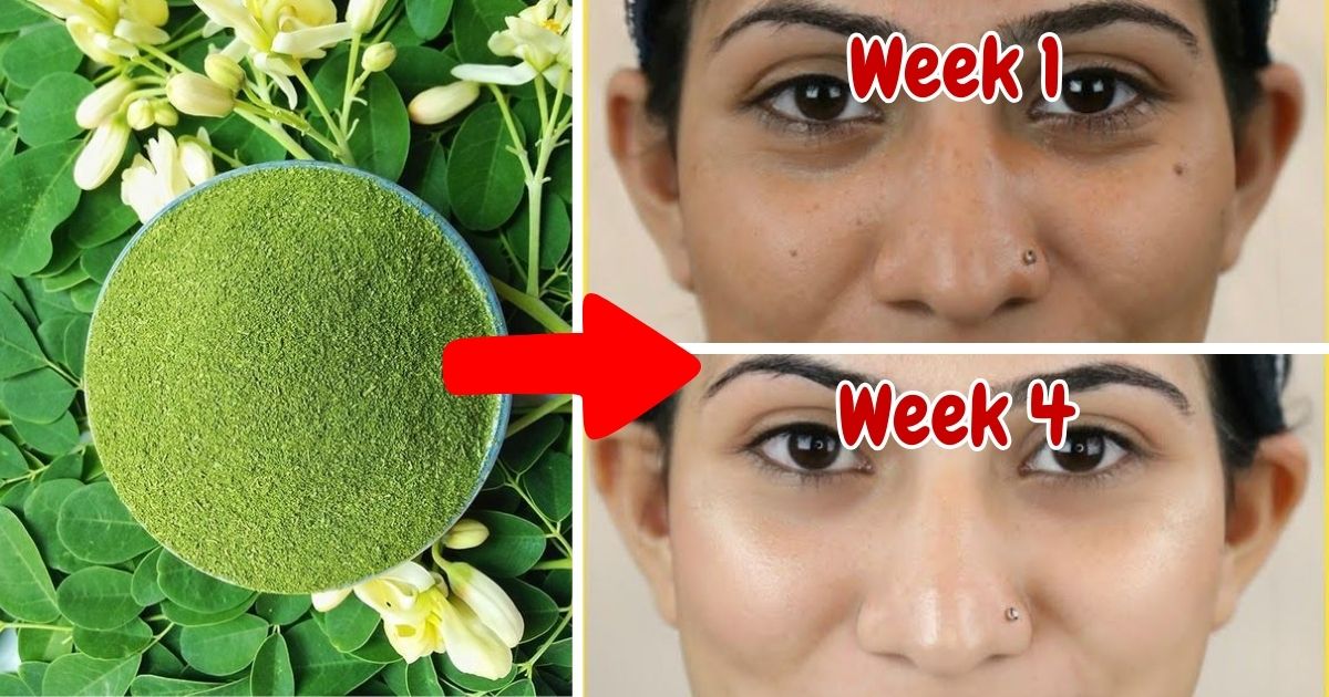 From Dull to Radiant: How Moringa Evens Out Skin Tone Naturally