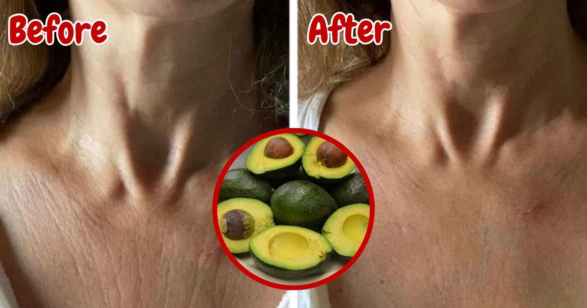 Why Avocado is the Anti-Wrinkle Secret Your Skin Needs