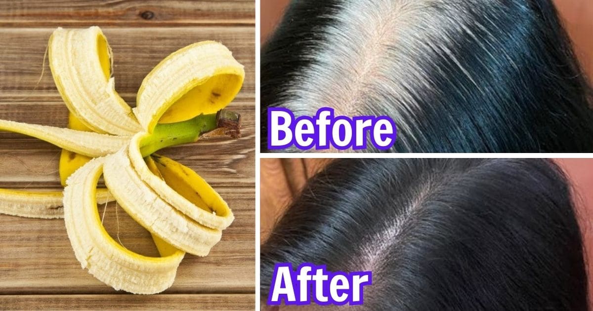 Here Is The Secret Recipe of Banana Peels to Turn Grandma’s Gray Hair ...