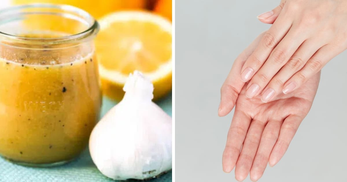 Soak Your Fingers in This Magic Mixture for Two Weeks and See the ...