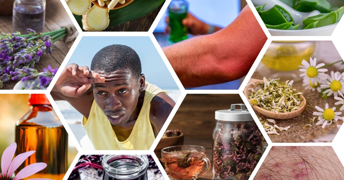 Your Ultimate Summer First Aid Kit: 10 Herbal Remedies for a Safe and ...