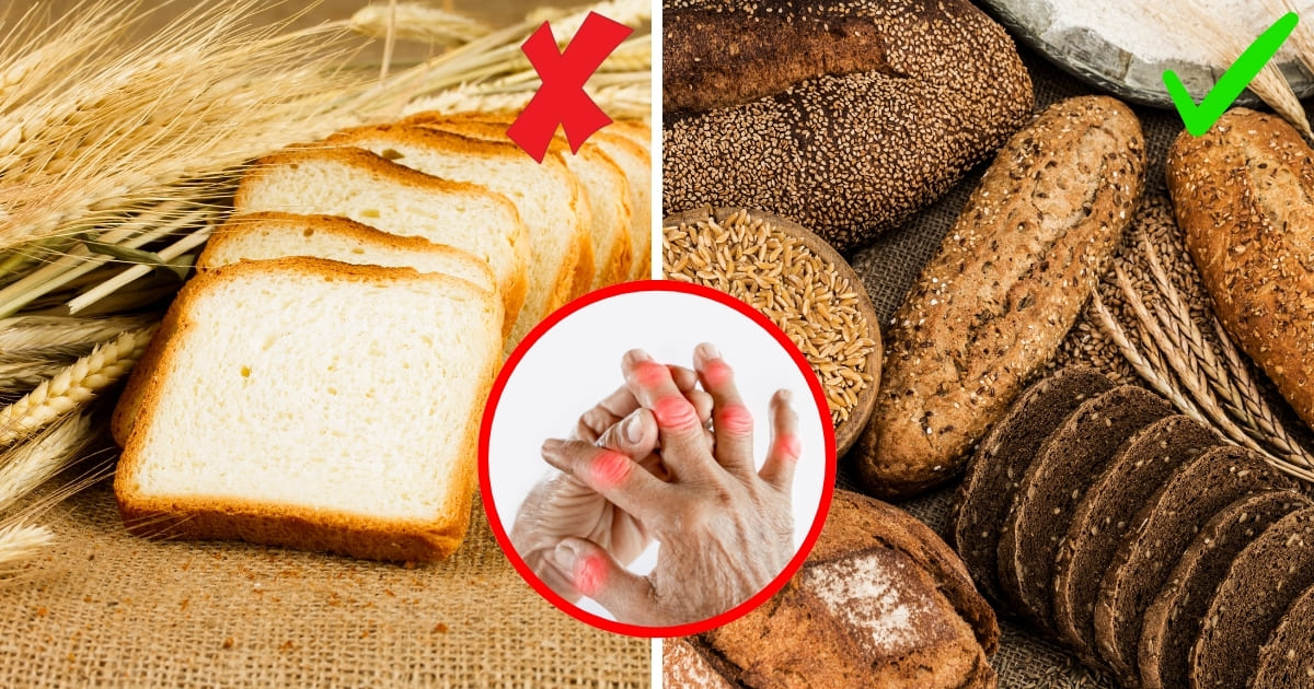 9 Foods to Avoid If You Have Arthritis and What to Eat Instead