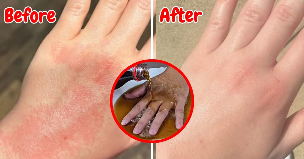 The Astonishing Benefits of Using Coca-Cola on Your Hands Revealed