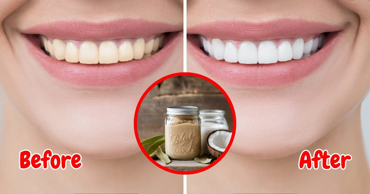 Bay Leaves for a Brighter Smile: The Secret Natural Tooth Whitener You ...